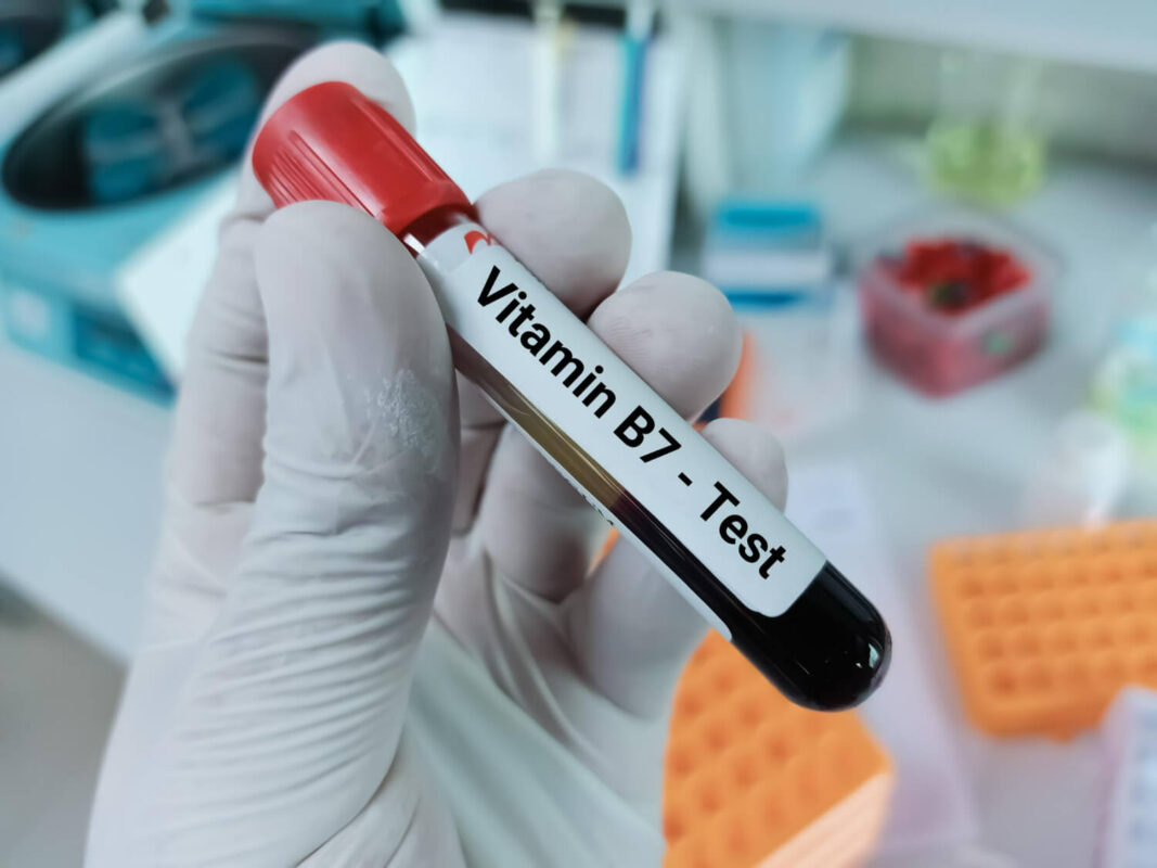 Biotina: Roluri, beneficii pentru sanatate si surse alimentare ...